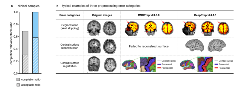 Nature Methods|刘河生课题组首创DeepPrep，加速走进神经影像的“大数据时代” - 鲁网财经频道